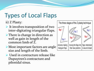 Skin grafts and skin flaps | PPTX