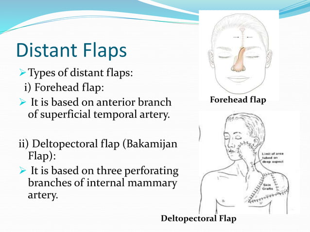 Skin grafts and skin flaps | PPTX | Death, Injury, or Military Conflict ...