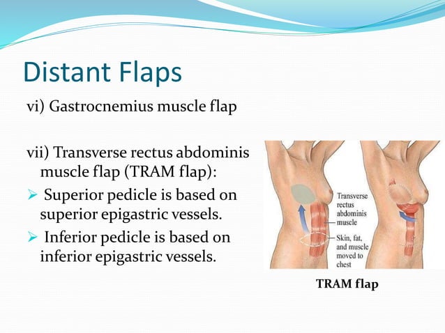Skin grafts and skin flaps