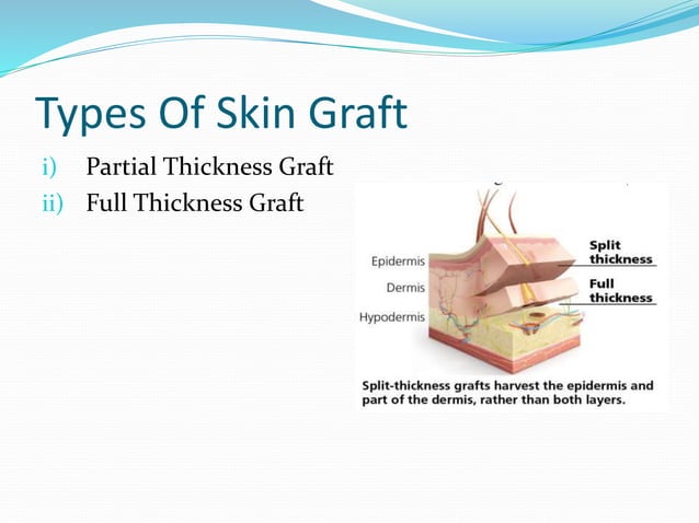 Skin grafts and skin flaps