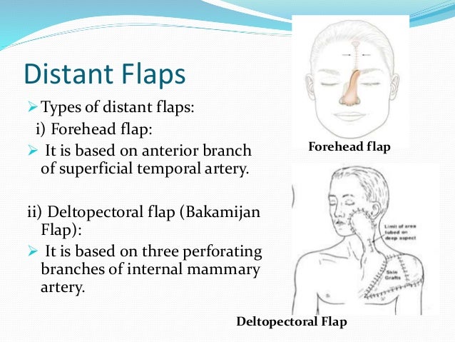 Skin grafts and skin flaps