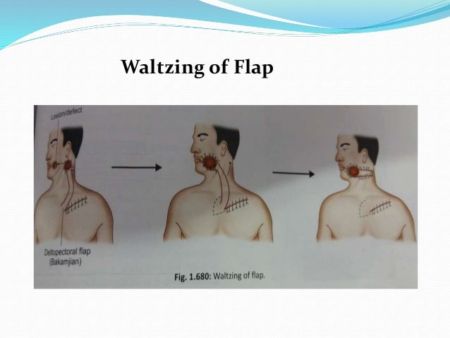 Skin grafts and skin flaps