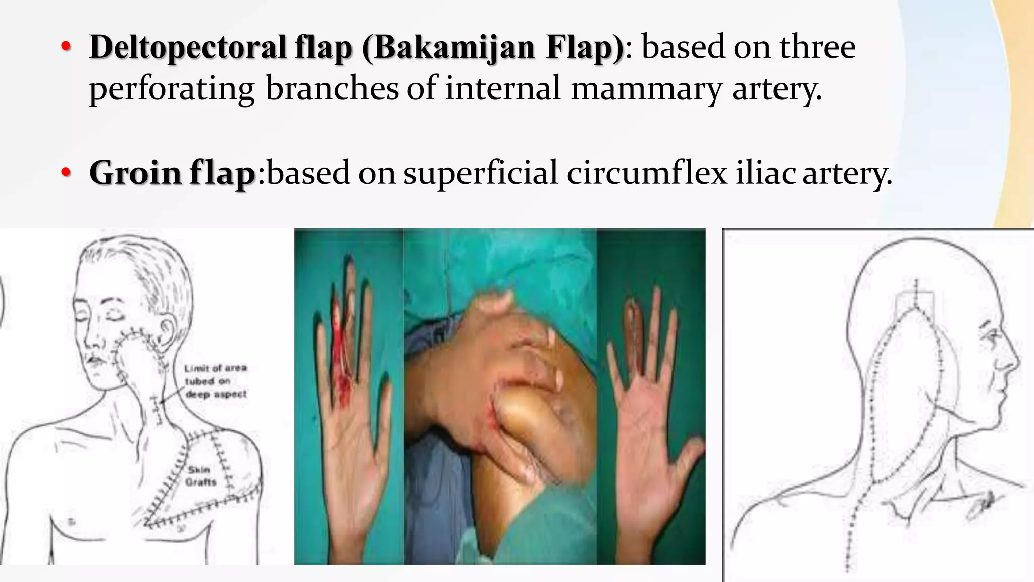 Skin grafts and skin flaps | PPTX