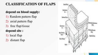 Skin grafts and skin flaps | PPTX