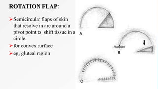 Skin grafts and skin flaps | PPTX