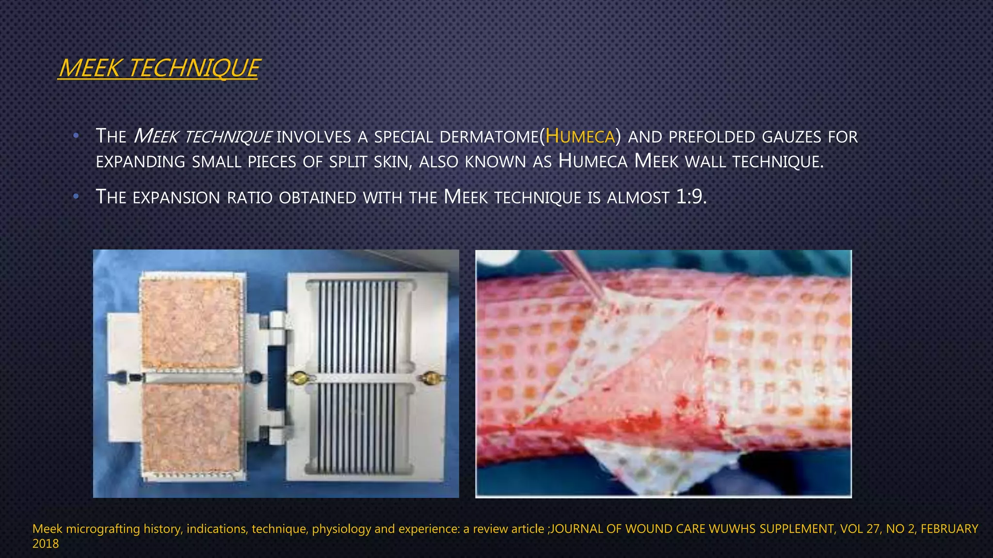 Skin grafts in oral and maxillofacial surgery | PPTX