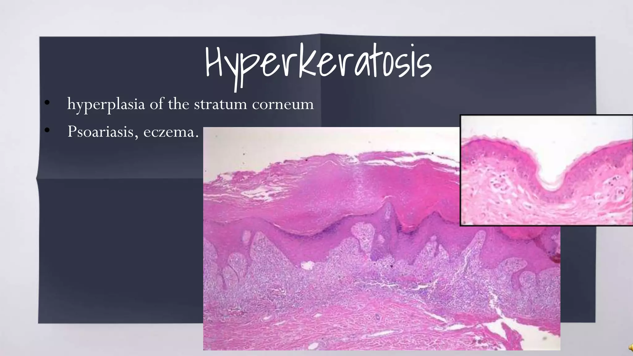 Skin histo patho changes dermatology ppt | PPTX