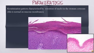 Skin histo patho changes dermatology ppt | PPTX