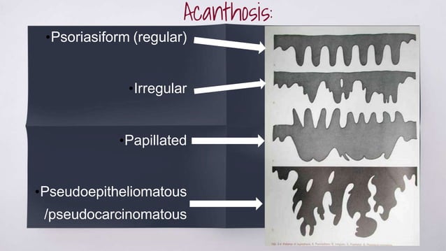 Skin histo patho changes dermatology ppt | PPTX | Skin and Dermatology ...