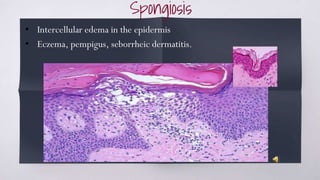 Skin histo patho changes dermatology ppt | PPTX