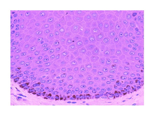 Normal Skin histology | PPTX | Skin and Dermatology | Diseases and ...