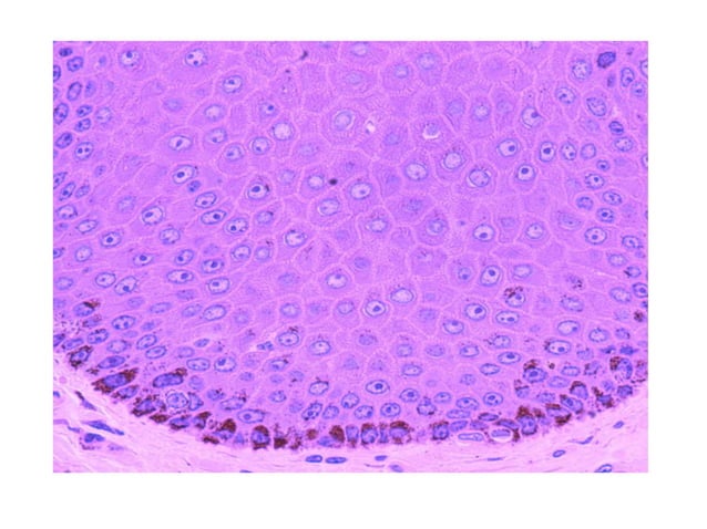 Normal Skin histology | PPTX | Skin and Dermatology | Diseases and ...