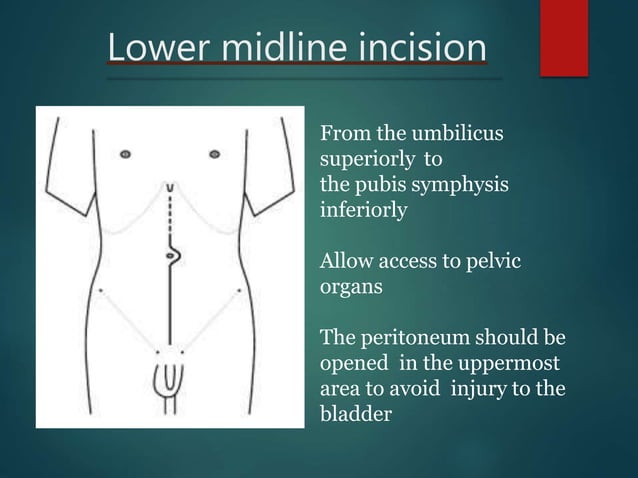 Skin incisions final | PPTX | Death, Injury, or Military Conflict ...