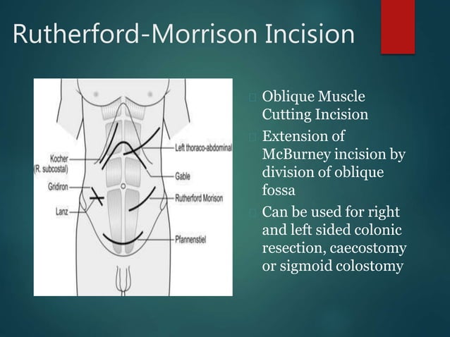 Skin incisions final | PPTX | Death, Injury, or Military Conflict ...