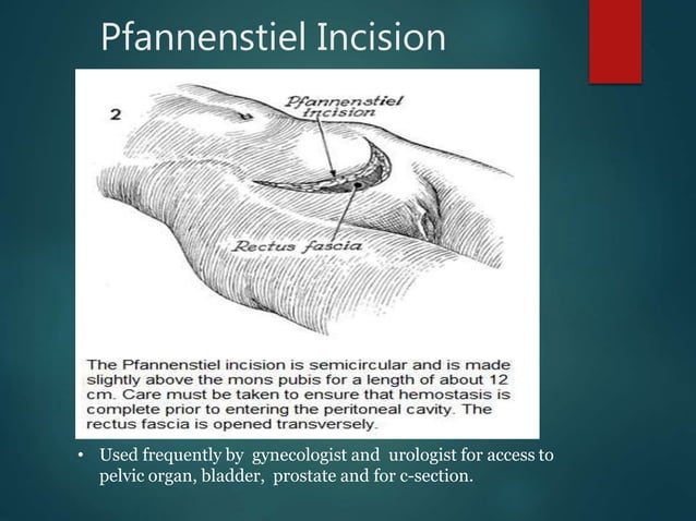 Skin incisions final | PPTX | Death, Injury, or Military Conflict ...