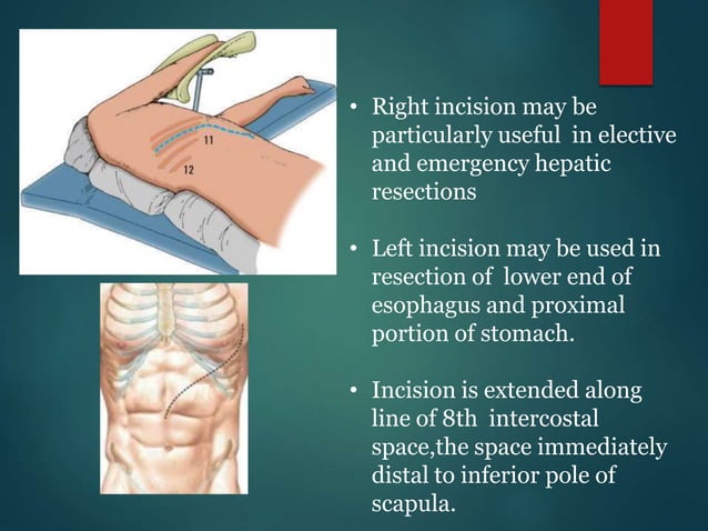 Skin incisions final | PPTX | Death, Injury, or Military Conflict ...