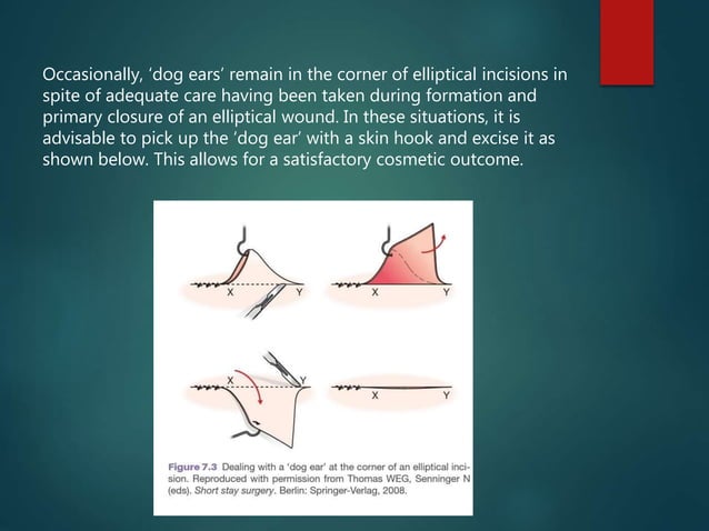 Skin incisions final | PPTX | Death, Injury, or Military Conflict ...
