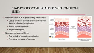 Common Skin infection in Children in Malaysia | PDF