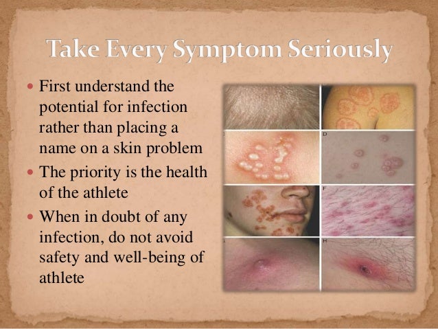 Skin Infection In Wrestlers
