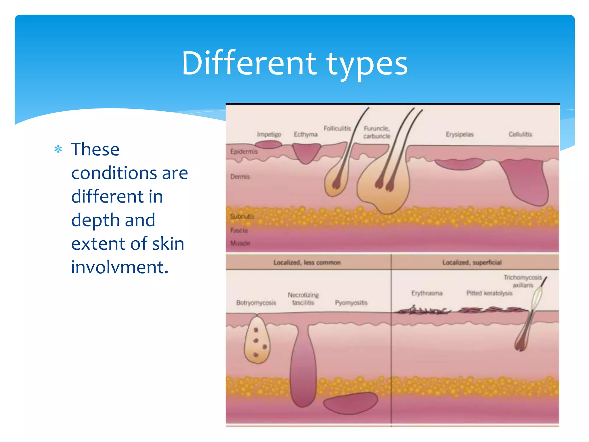 Skin infections | PPTX