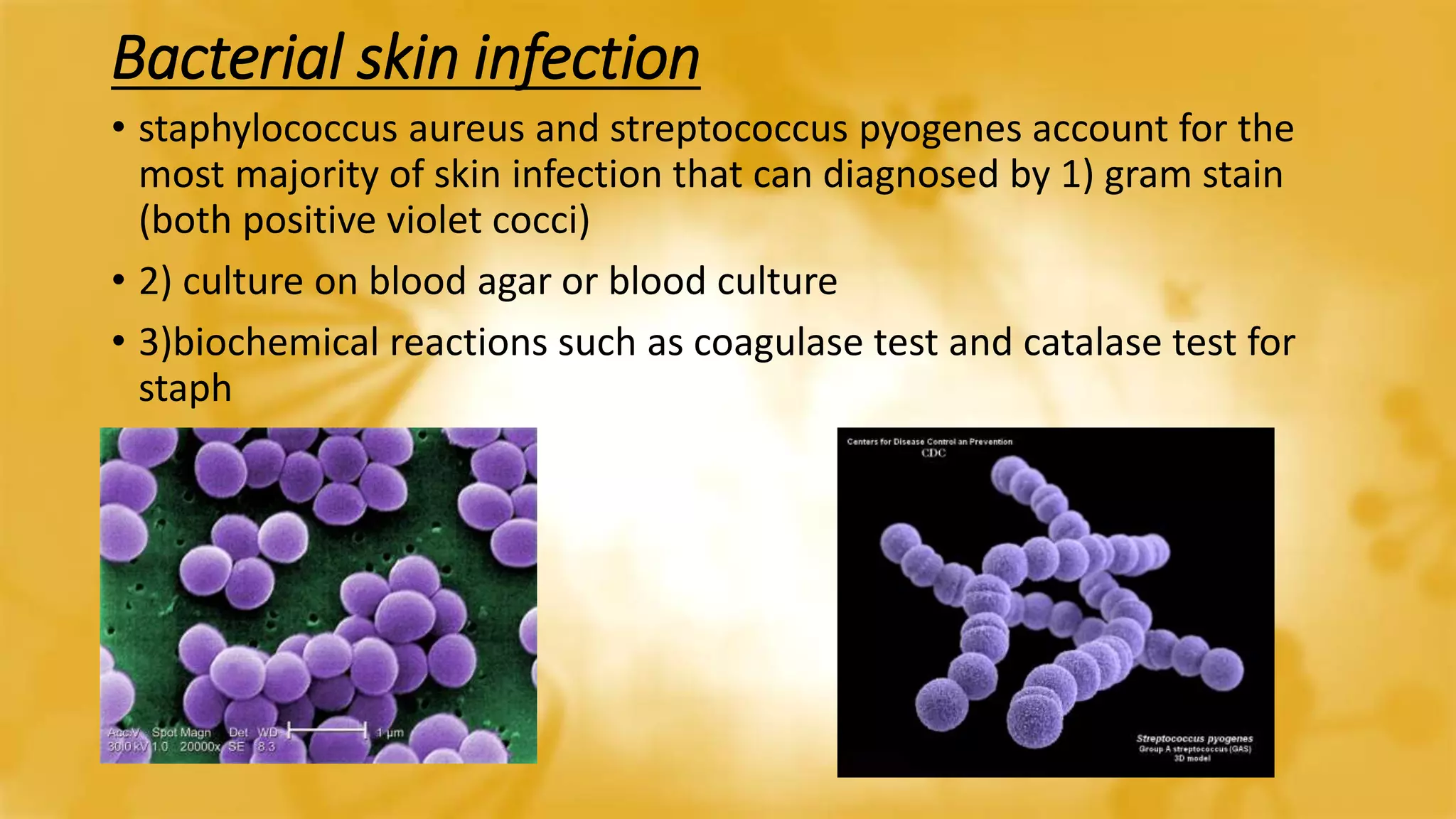 Skin infections | PPTX
