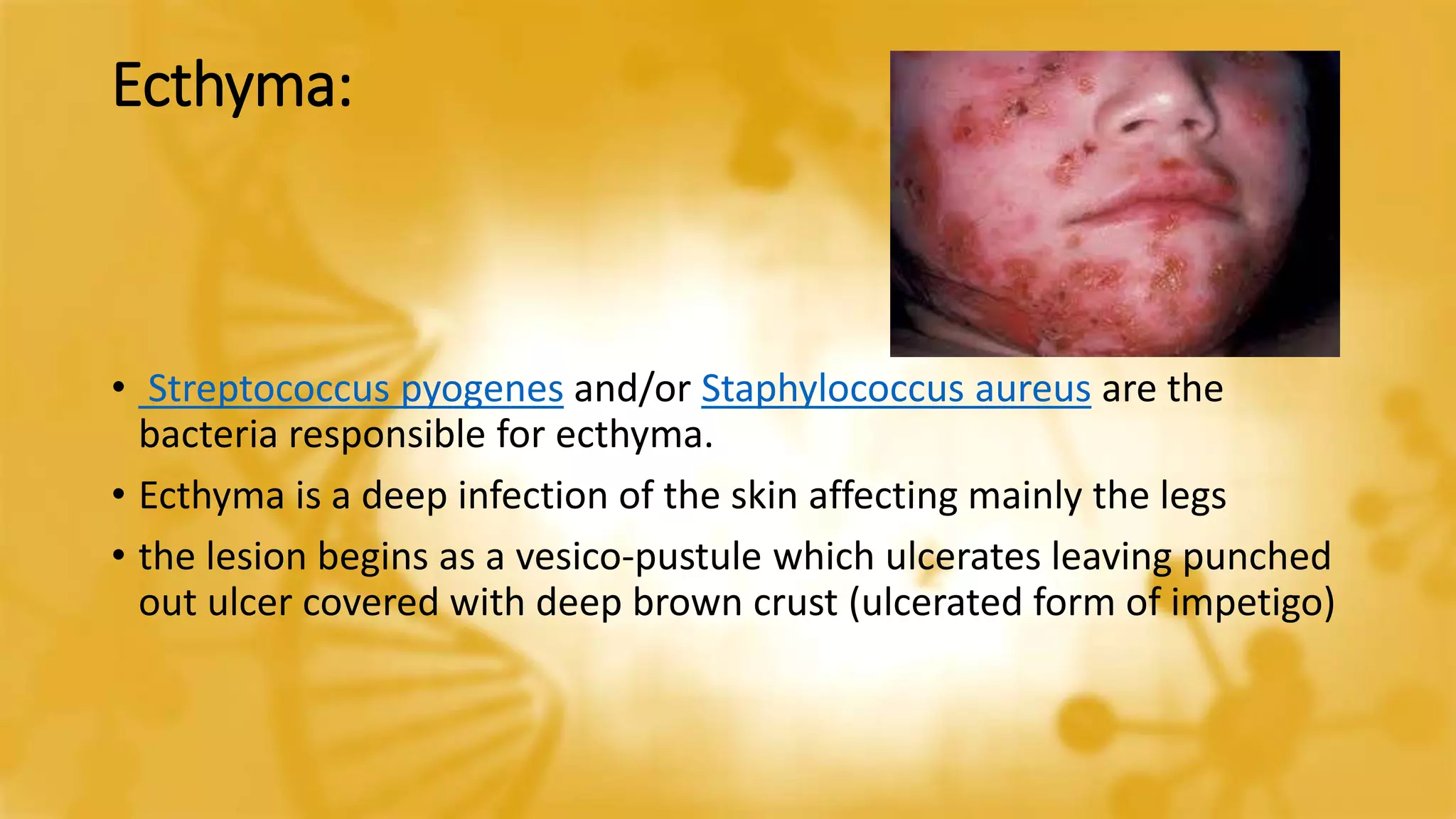 Skin infections | PPTX