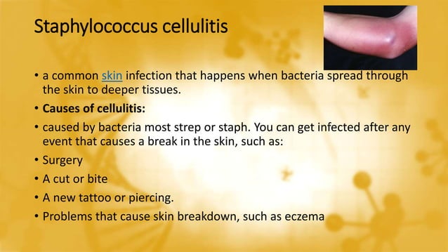 Skin infections | PPTX