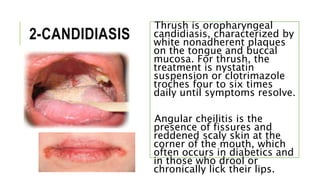 Skin infections | PPTX