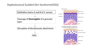 A short discussion on skin infections and management | PPTX ...