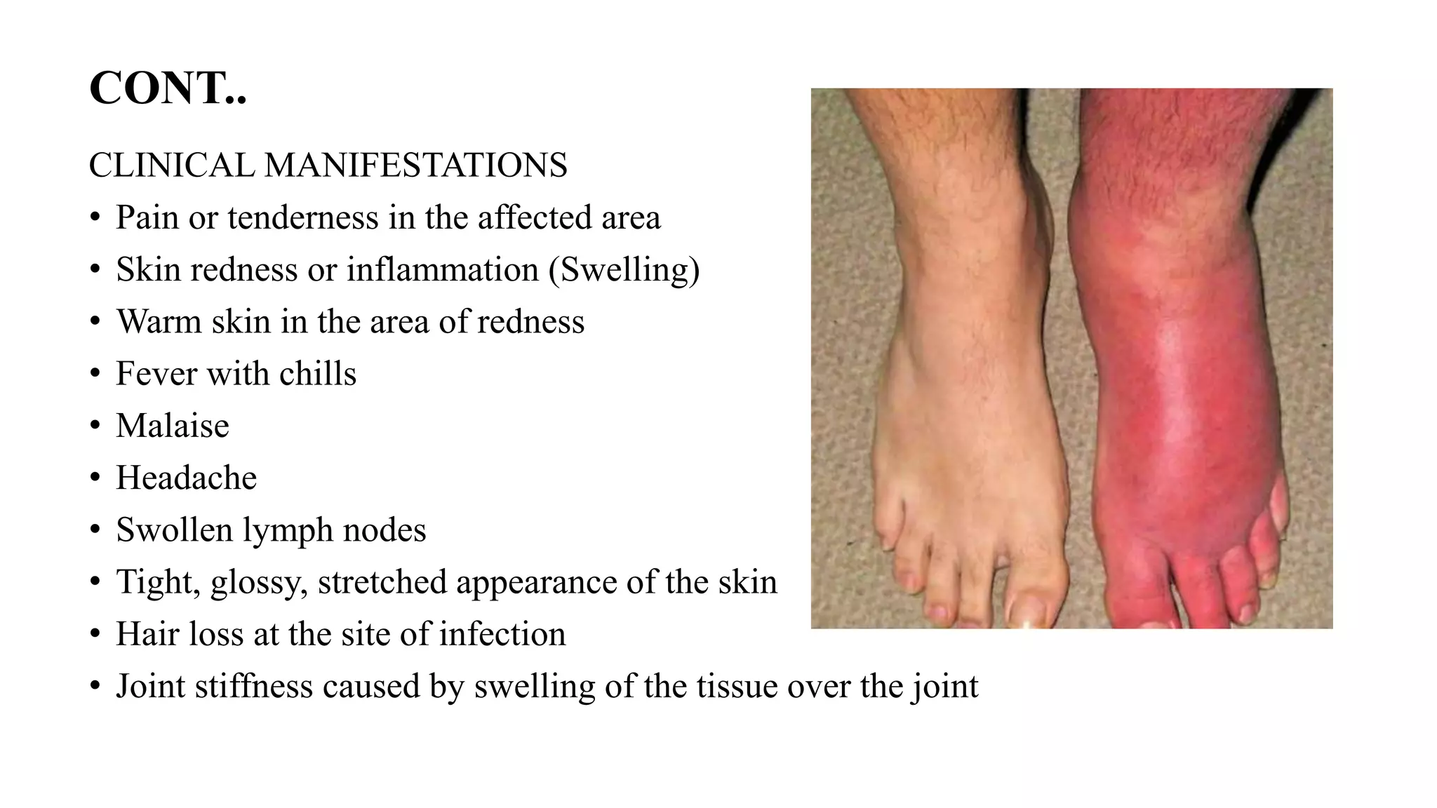 skin infections_121240.pptx