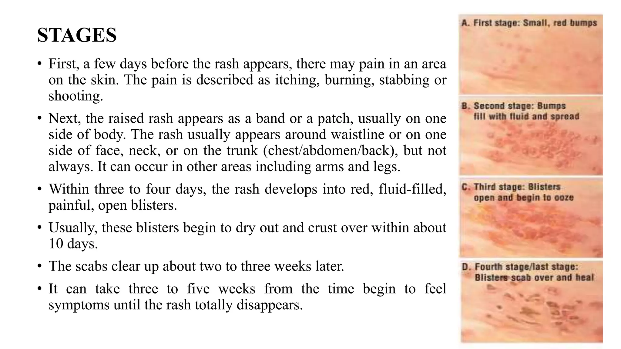 skin infections_121240.pptx
