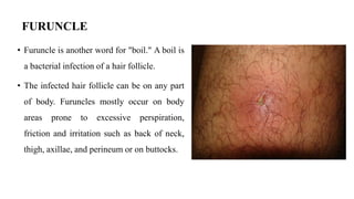 skin infections_123614.pptx