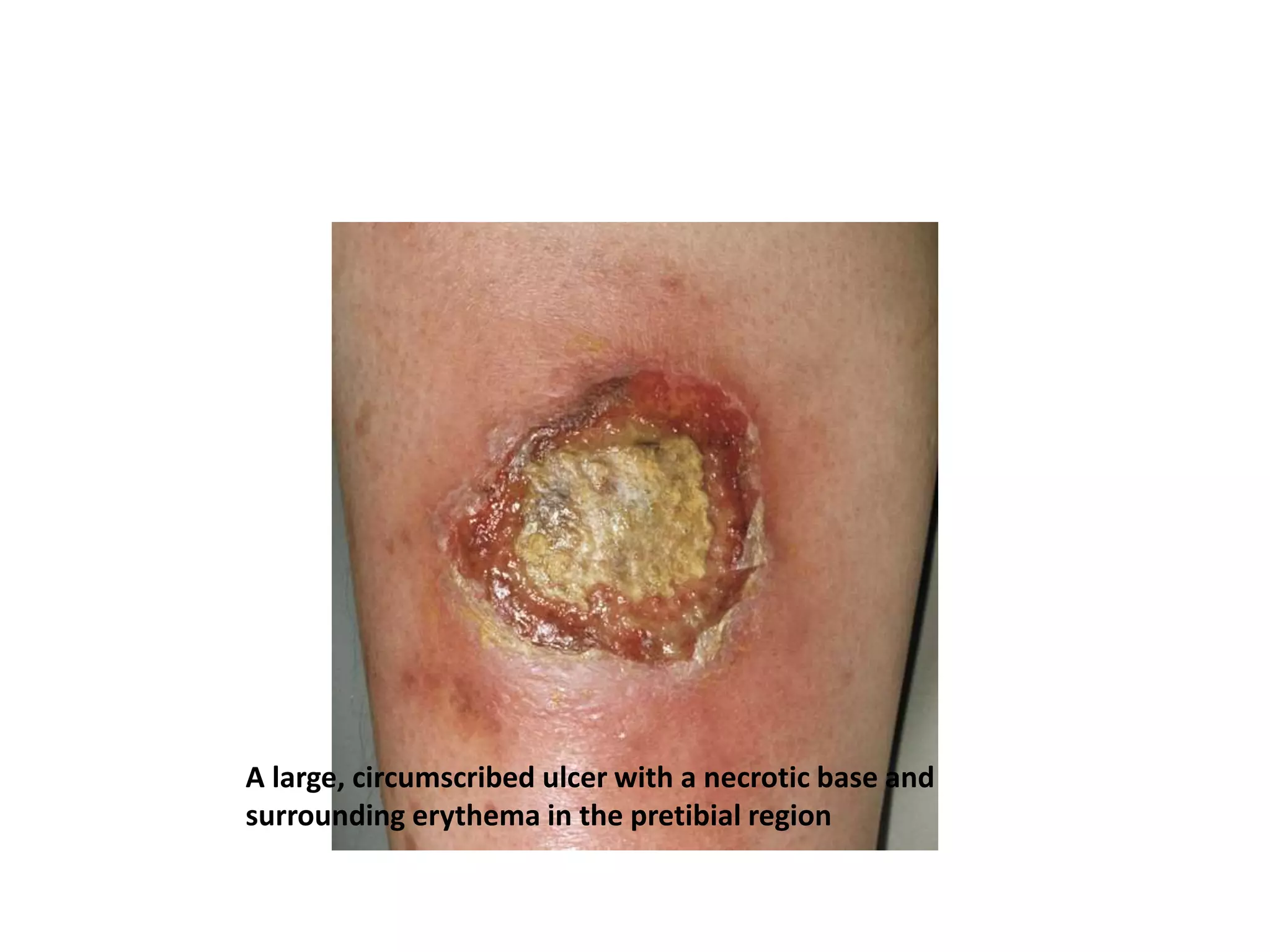 skin infections bacterial.pptx