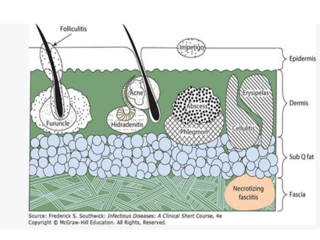 skin infections bacterial.pptx