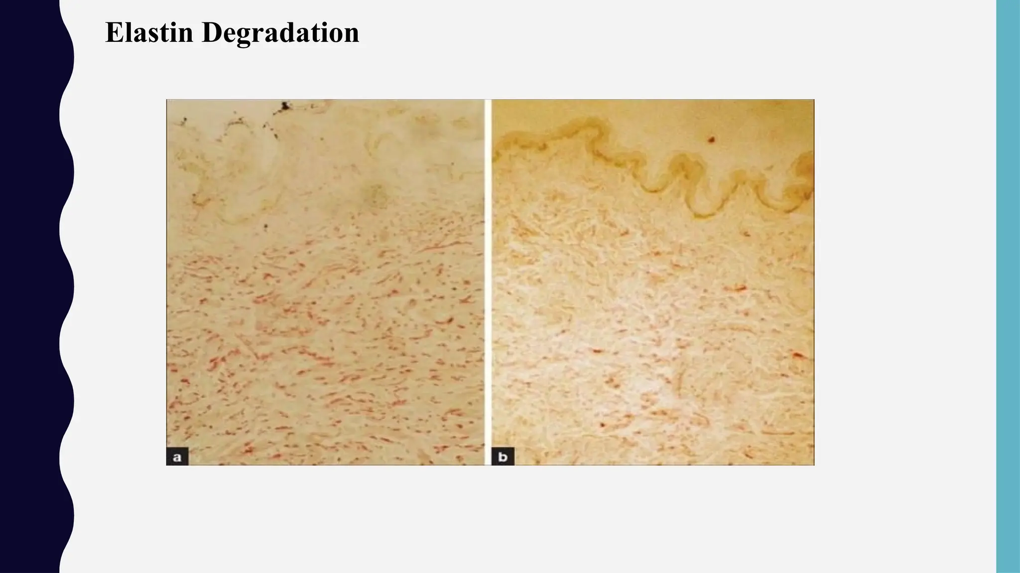 Skin in Old Age, Pathophysiology, Intrinsic and Extrinsic factors ...
