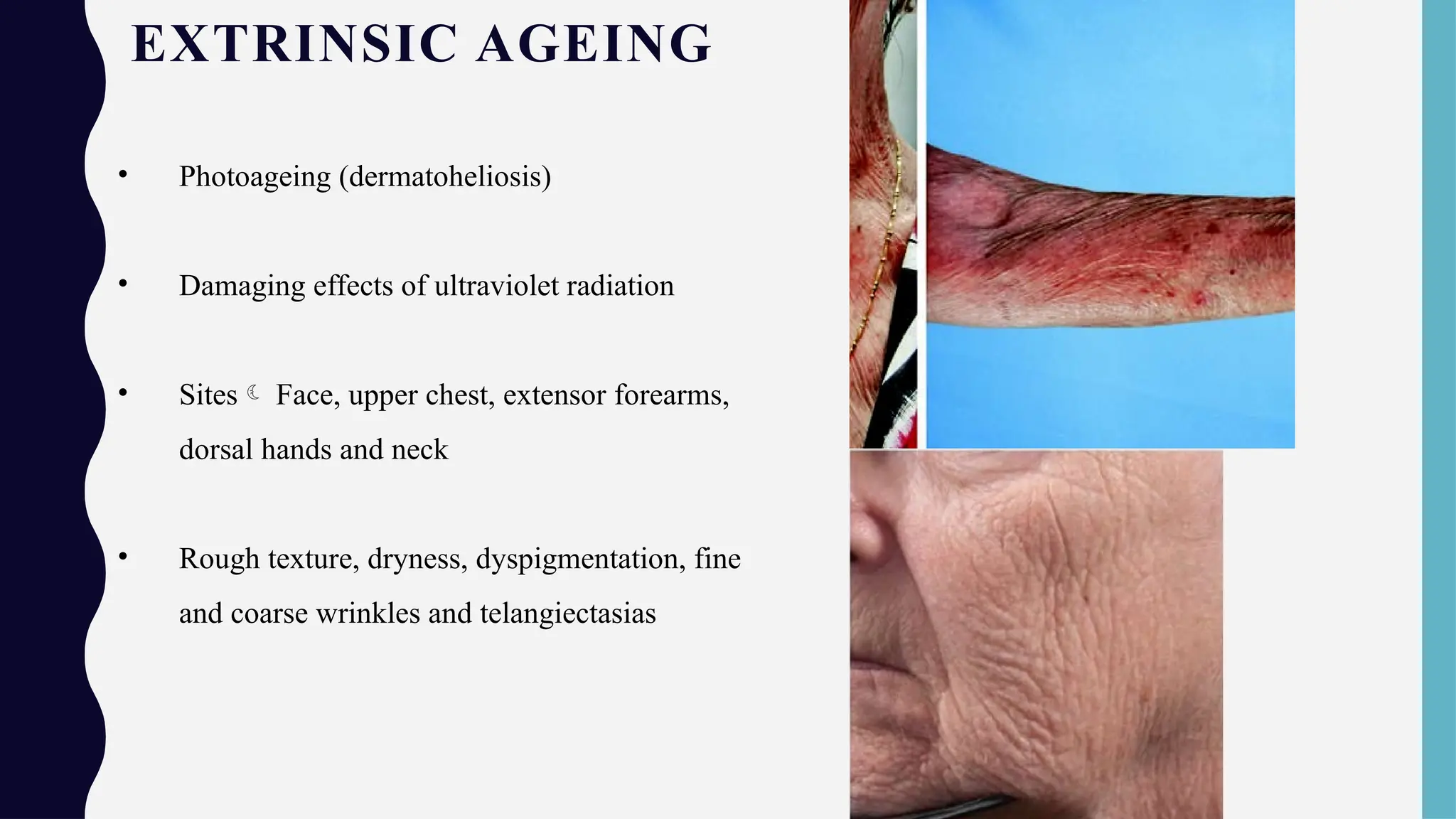 Skin in Old Age, Pathophysiology, Intrinsic and Extrinsic factors ...