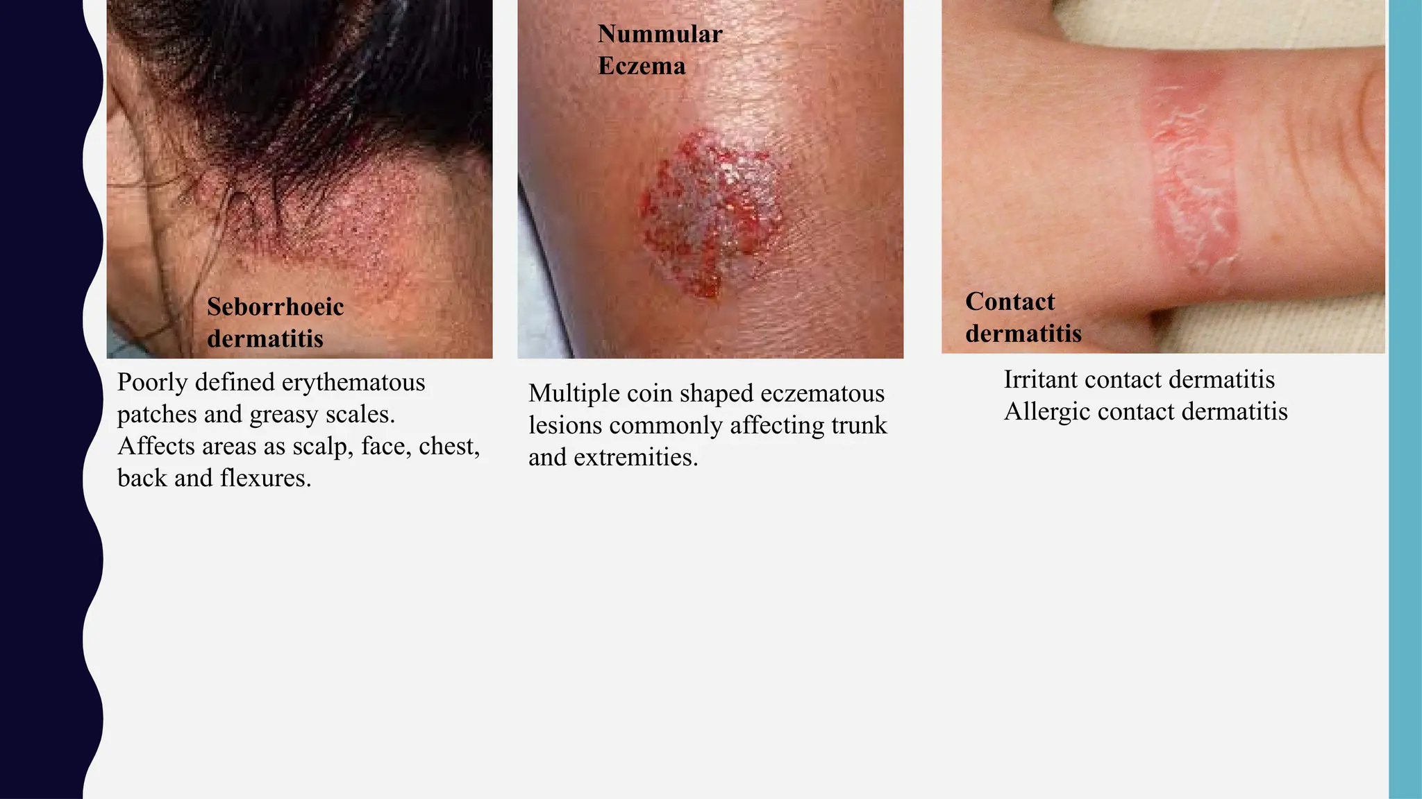 Skin in Old Age, Pathophysiology, Intrinsic and Extrinsic factors ...