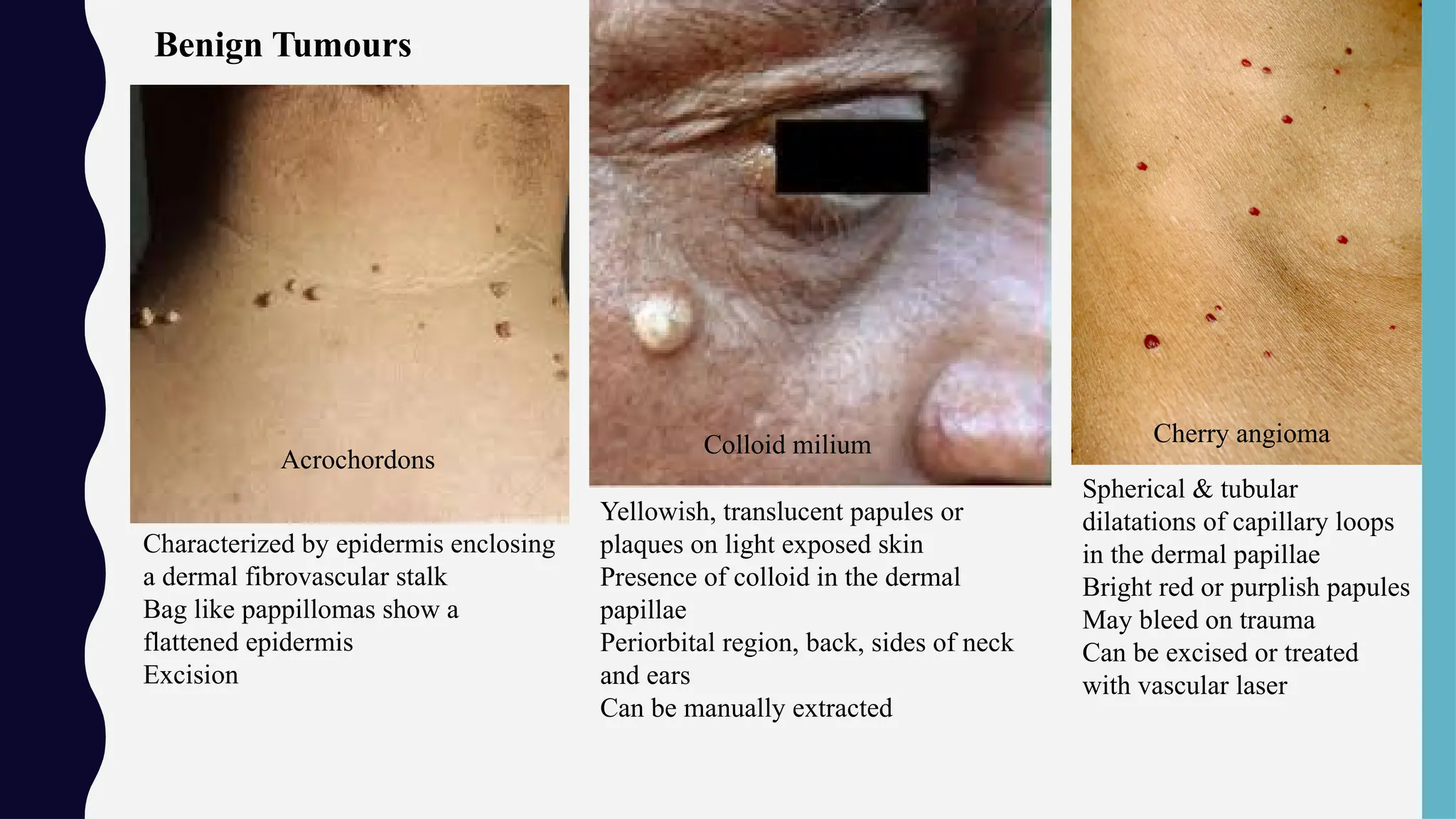Skin in Old Age, Pathophysiology, Intrinsic and Extrinsic factors ...