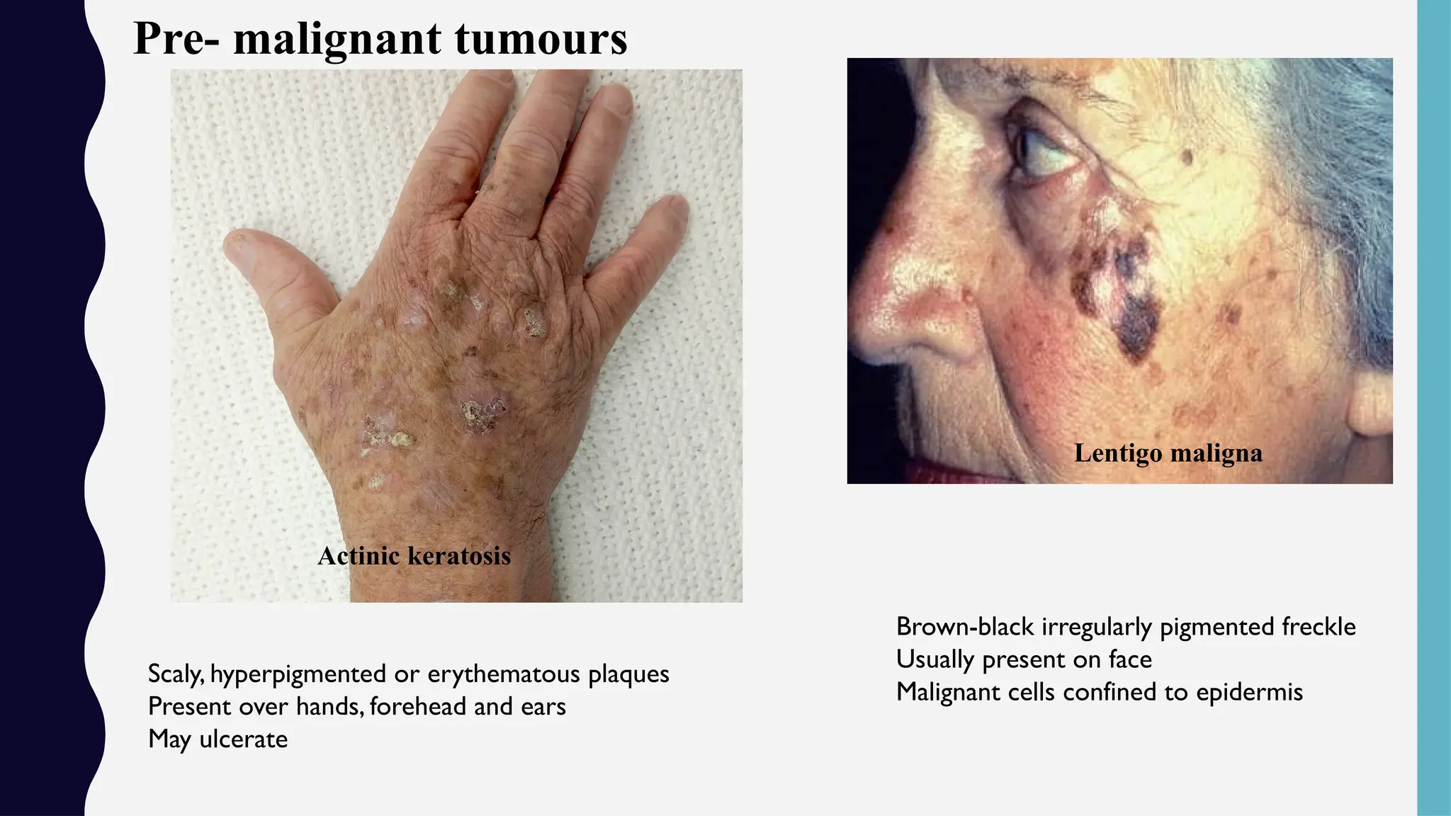 Skin in Old Age, Pathophysiology, Intrinsic and Extrinsic factors ...