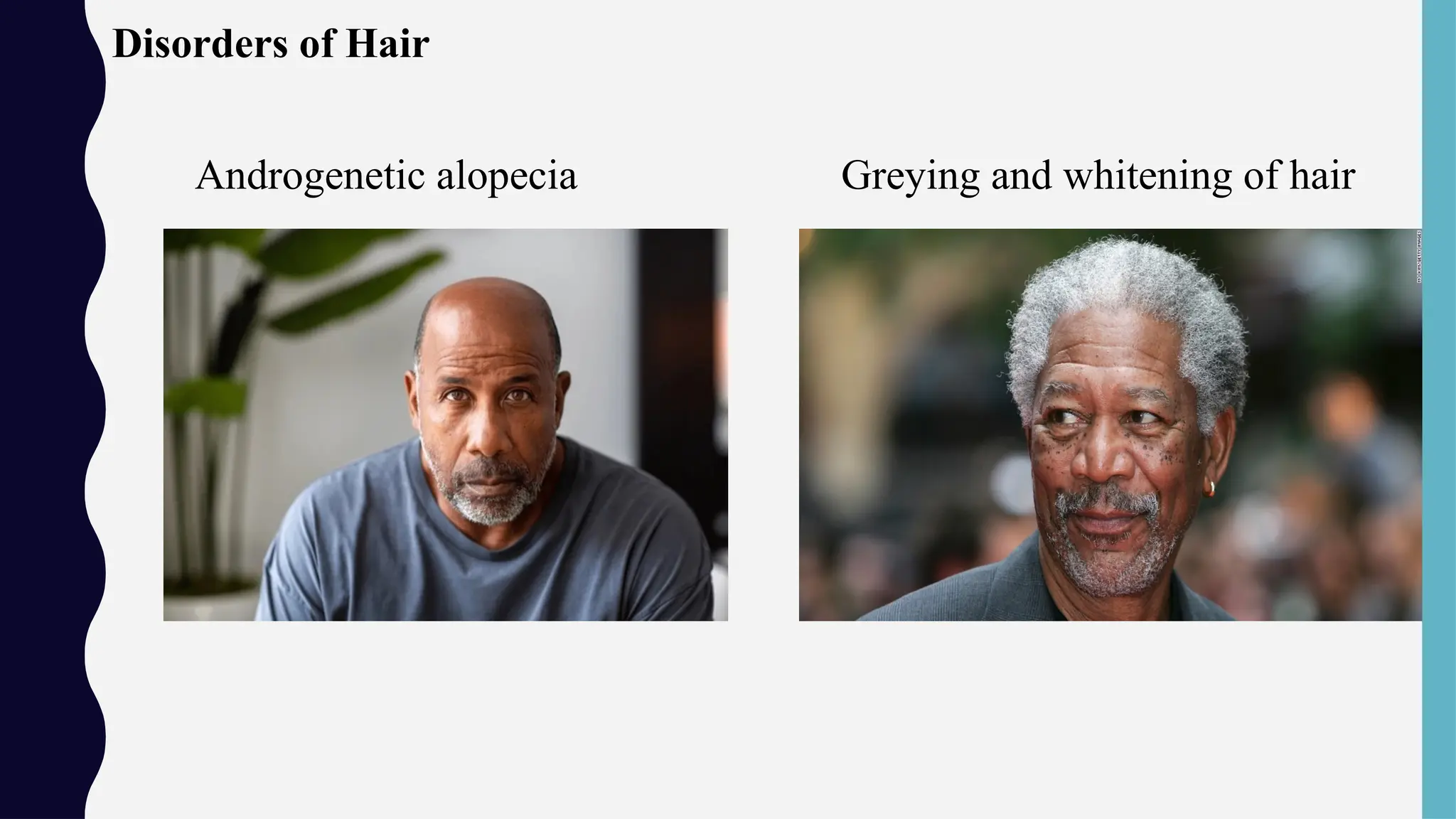 Skin in Old Age, Pathophysiology, Intrinsic and Extrinsic factors ...