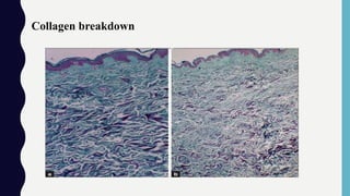 Skin in Old Age, Pathophysiology, Intrinsic and Extrinsic factors ...