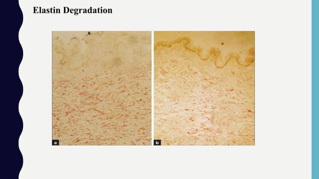 Skin in Old Age, Pathophysiology, Intrinsic and Extrinsic factors ...