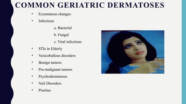 Skin in Old Age, Pathophysiology, Intrinsic and Extrinsic factors ...