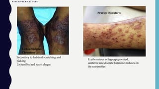 Skin in Old Age, Pathophysiology, Intrinsic and Extrinsic factors ...