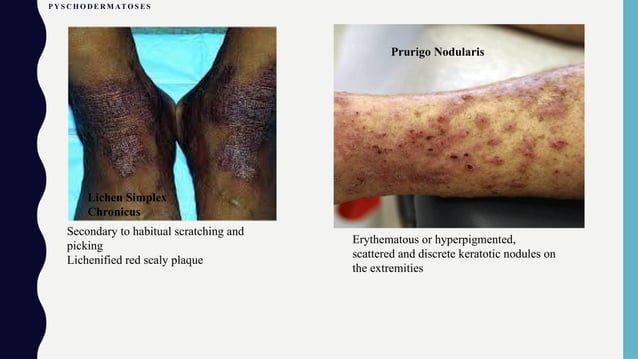 Skin in Old Age, Pathophysiology, Intrinsic and Extrinsic factors ...