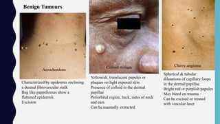 Skin in Old Age, Pathophysiology, Intrinsic and Extrinsic factors ...