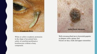 Skin in Old Age, Pathophysiology, Intrinsic and Extrinsic factors ...