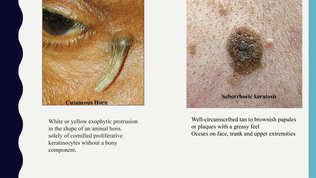 Skin in Old Age, Pathophysiology, Intrinsic and Extrinsic factors ...