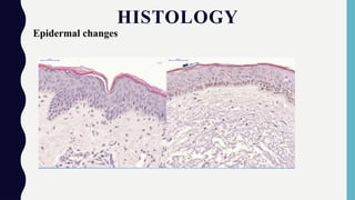 Skin in Old Age, Pathophysiology, Intrinsic and Extrinsic factors ...