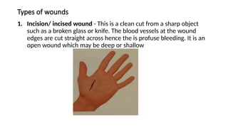 SKIN INTEGRITY AND WOUND CAREd RNAC2pptx | PPTX | Death, Injury, or ...